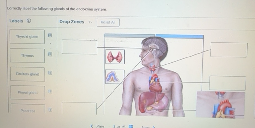 Solved: Correctly label the following glands of the endocrine system ...