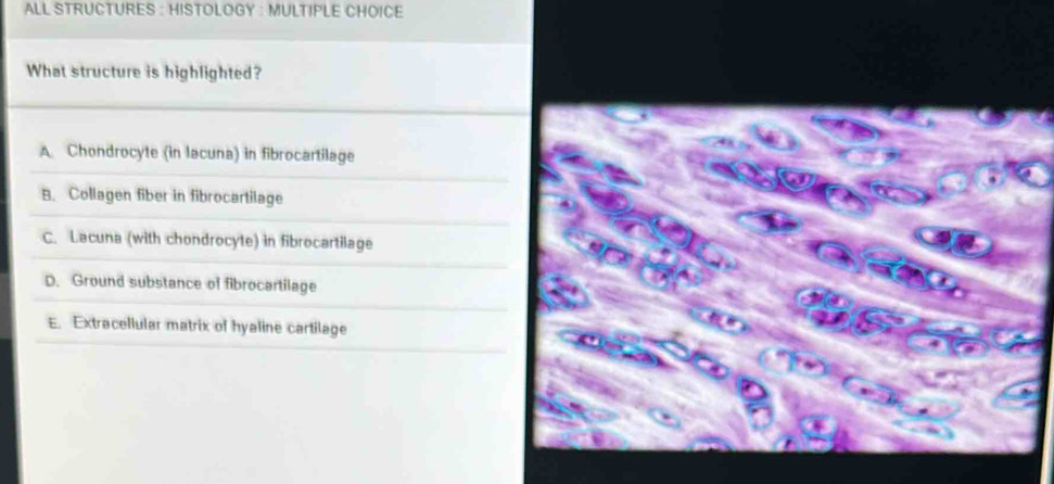 Solved: ALL STRUCTURES : HISTOLOGY : MULTIPLE CHOICE What structure is ...