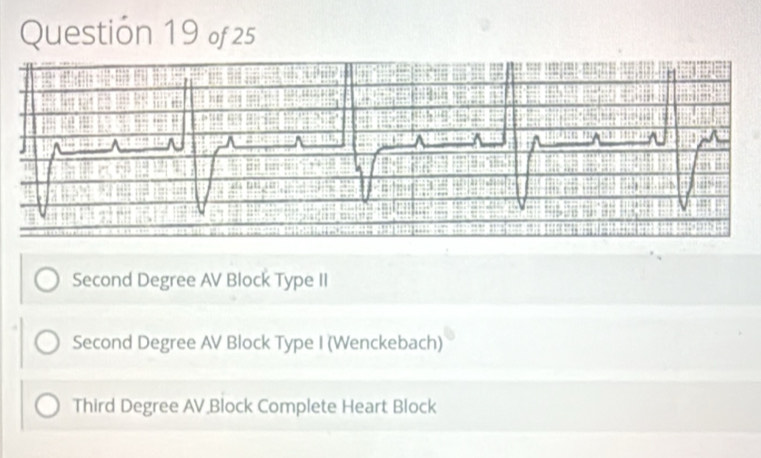 Solved: Questión 19 of 25 Second Degree AV Block Type II Second Degree ...
