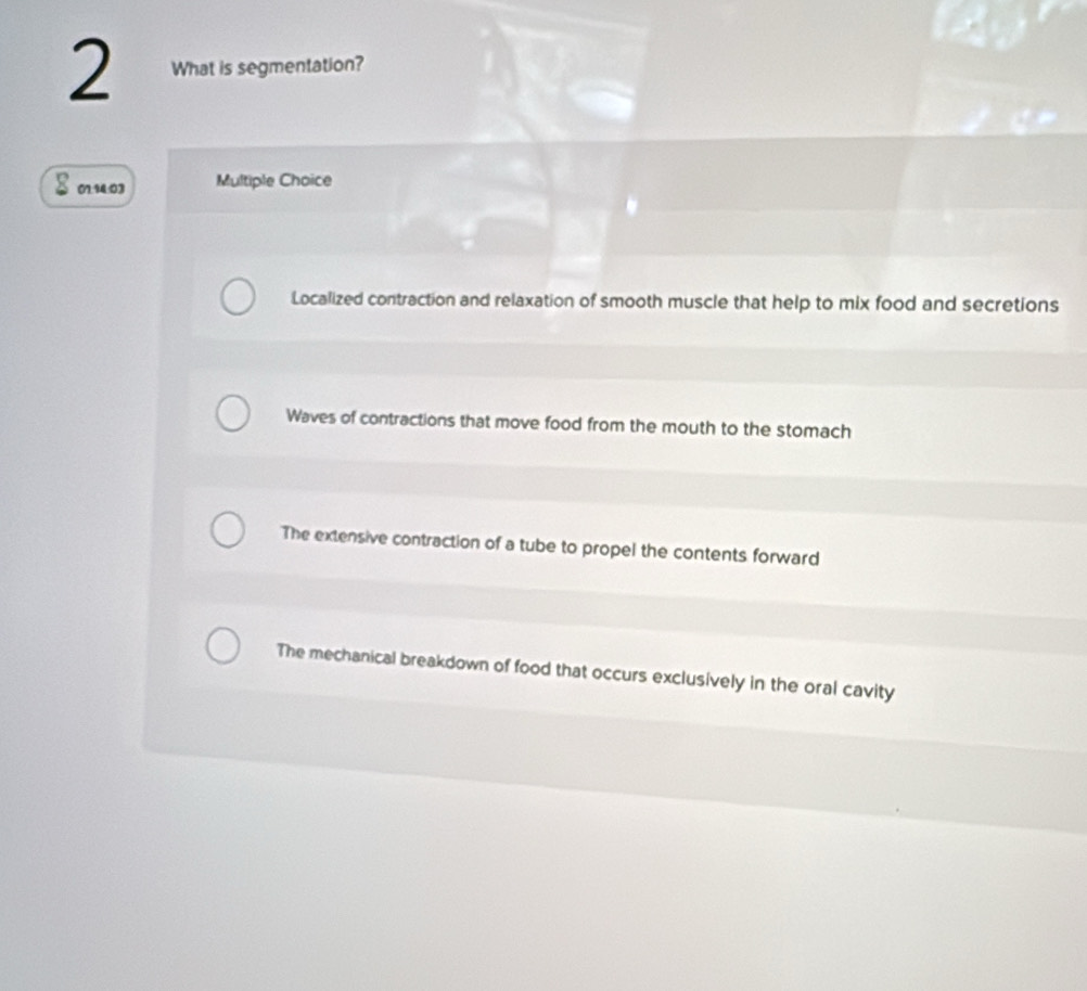 Solved: What is segmentation? 01:94:03 Multiple Choice Localized ...