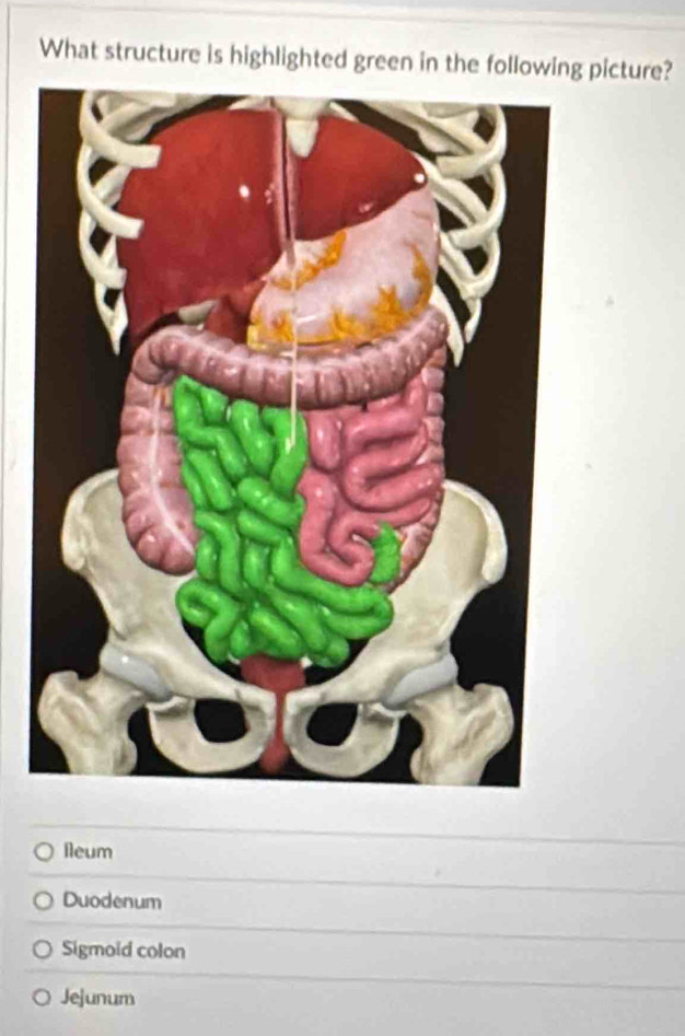 Solved: What structure is highlighted green in the following picture ...