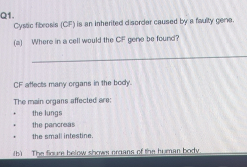 Solved: Cystic fibrosis (CF) is an inherited disorder caused by a ...