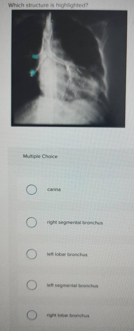 Solved: Which structure is highlighted? Multiple Choice carina right ...