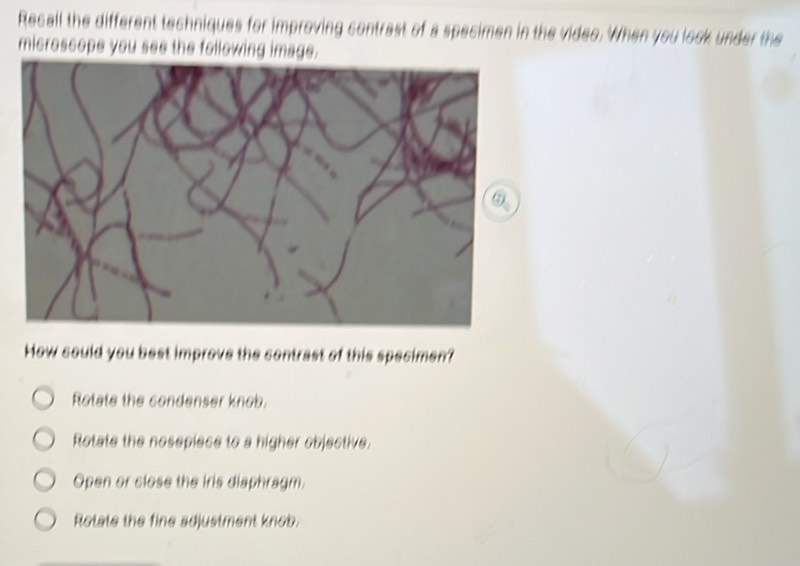 Solved: Recall the different techniques for improving contrast of a ...