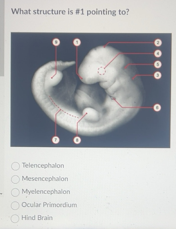 Solved: What structure is # 1 pointing to? Telencephalon Mesencephalon ...