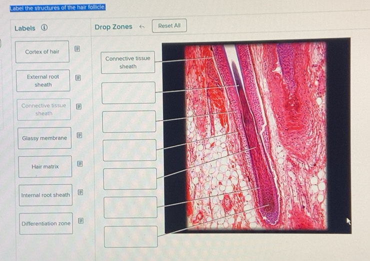 Solved: Label the structures of the hair follicle Labels Drop Zones ...