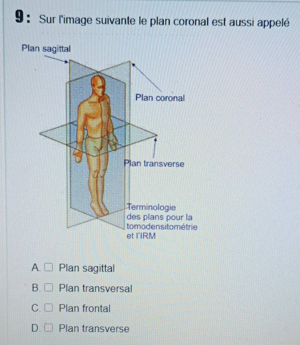 Résolu :Sur l'image suivante le plan coronal est aussi appelé A. Plan ...