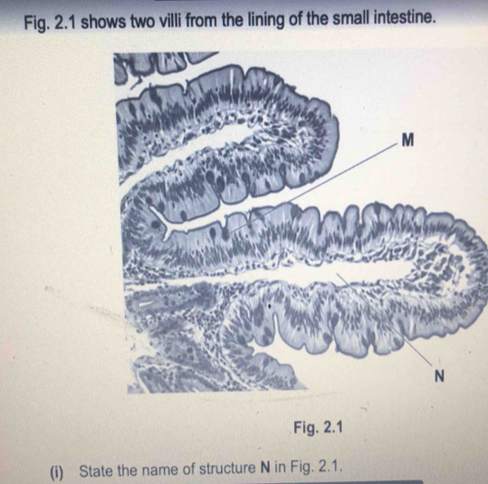Solved: Fig. 2.1 shows two villi from the lining of the small intestine ...