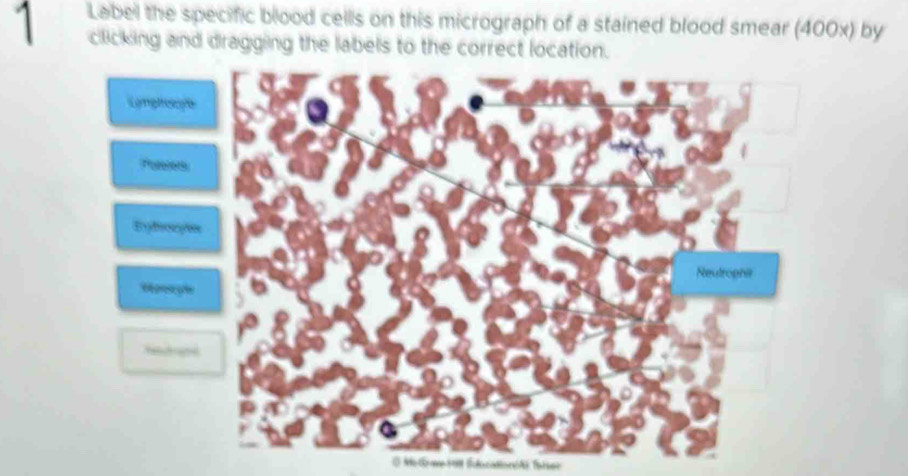 Solved: Label the specific blood cells on this micrograph of a stained ...