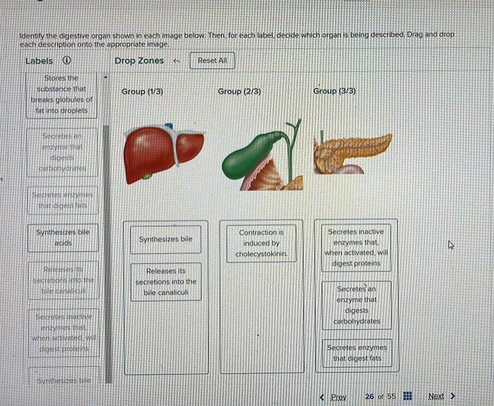 Solved: Identify the digestive organ shown in each image below. Then ...