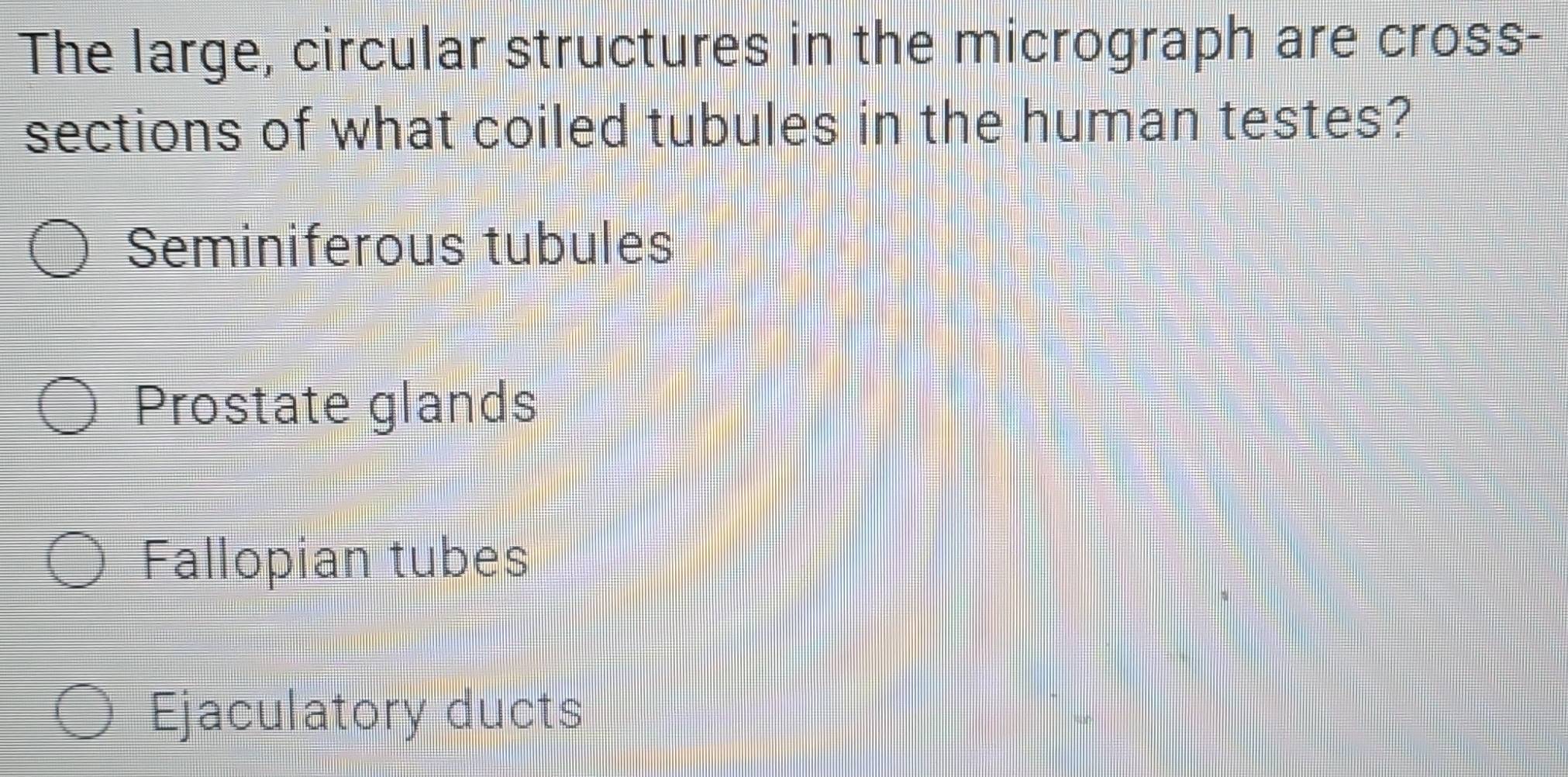 Solved: The large, circular structures in the micrograph are cross ...