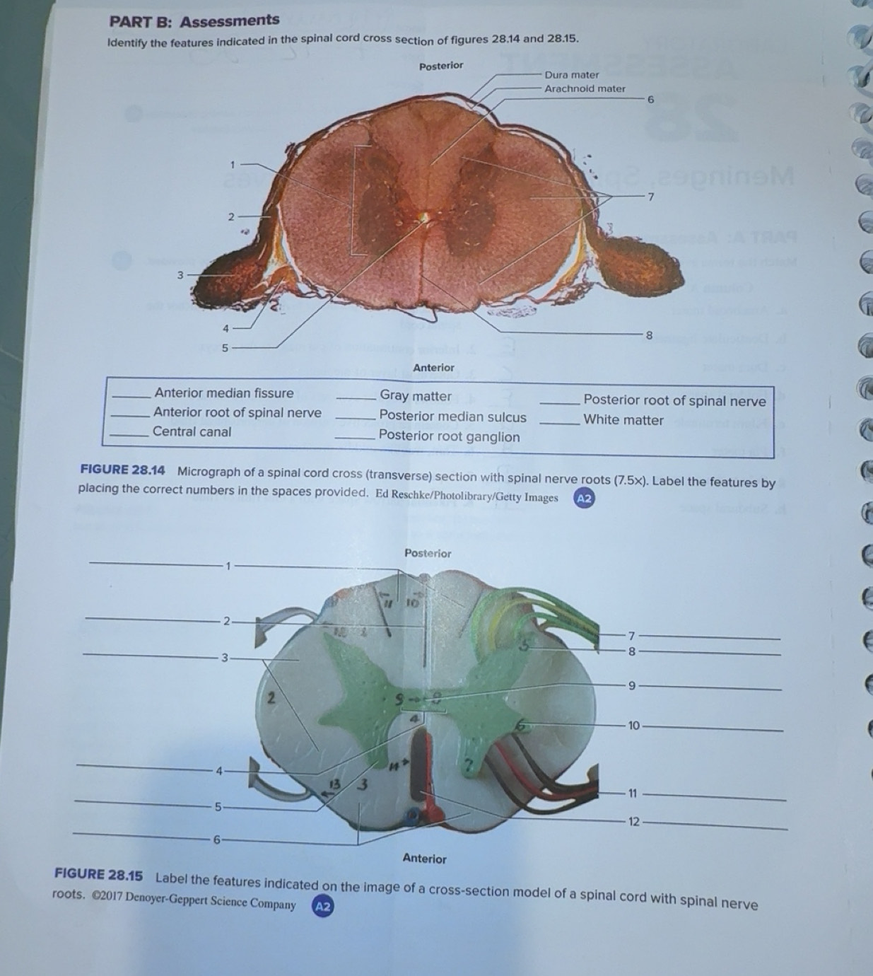 Solved: Assessments Identify the features indicated in the spinal cord ...