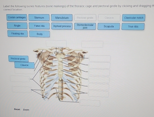 Solved: Label the following bones features (bone markings) of the ...