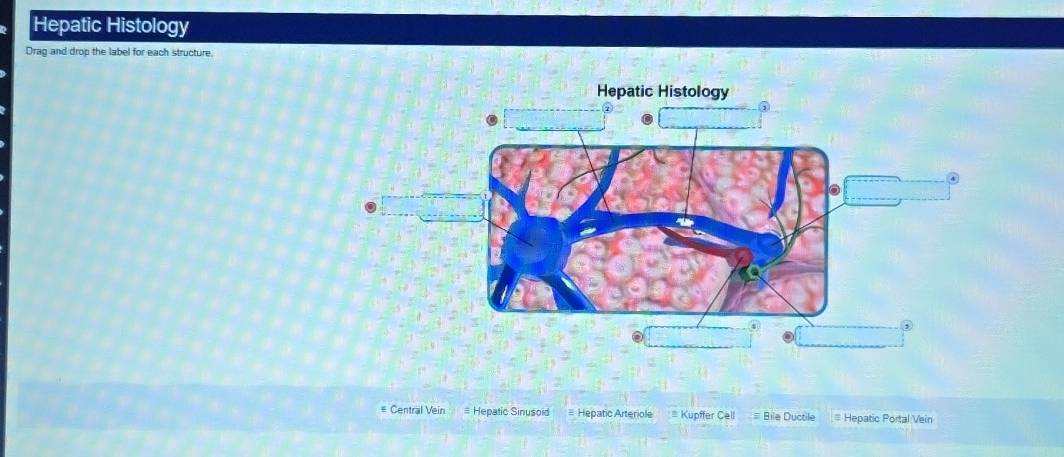 Solved: Hepatic Histology Drag and drop the label for each structure ...