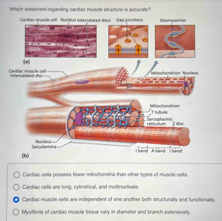 Solved: Which statement regarding cardiac muscle structure is accurate ...
