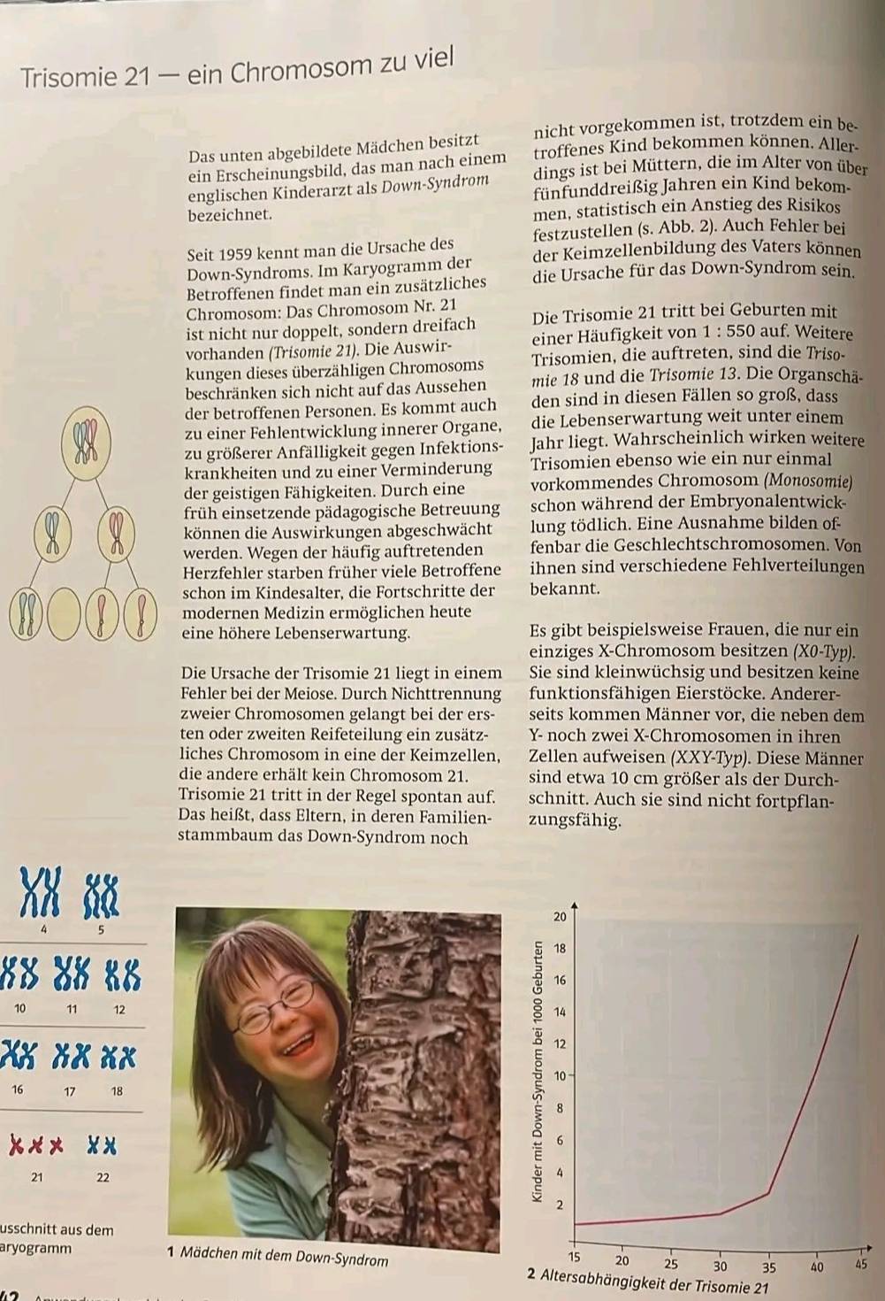 Gelöst:Trisomie 21 — ein Chromosom zu viel nicht vorgekommen ist ...