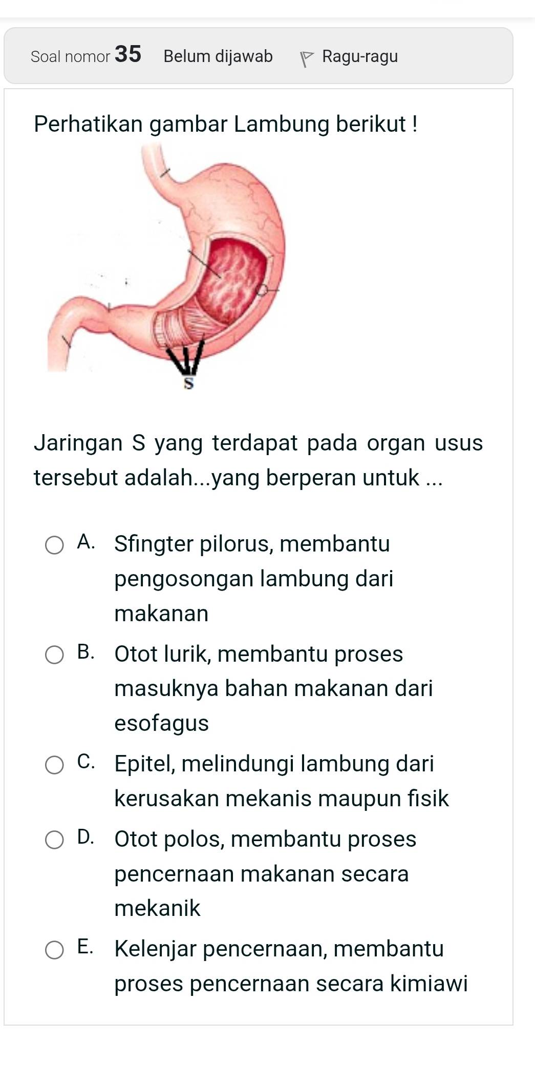 Telah dijawab:Soal nomor 35 Belum dijawab Ragu-ragu Perhatikan gambar ...