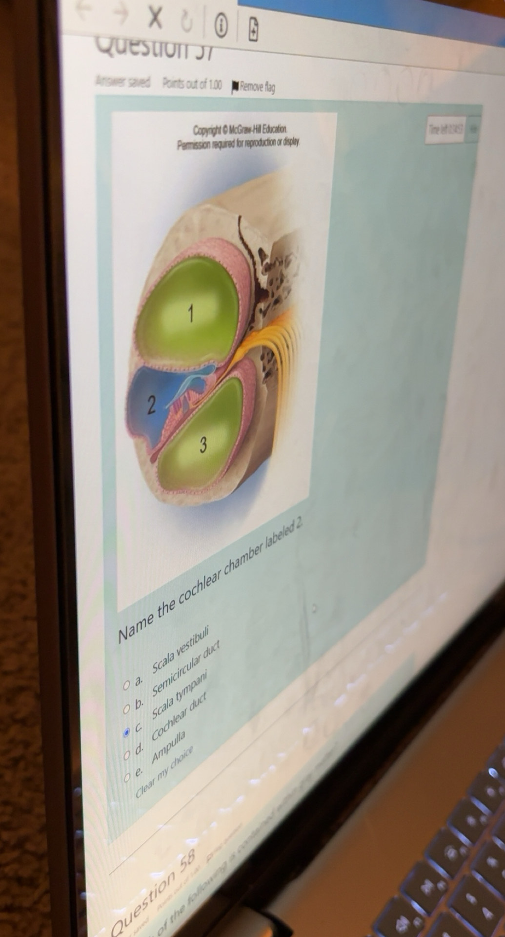 Solved: Question J7 Answer saved Points out of 1.00 Remove lag ...