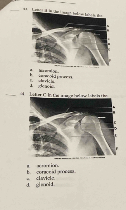 Solved: Letter B in the image below labels the a. acromion. b. coracoid ...