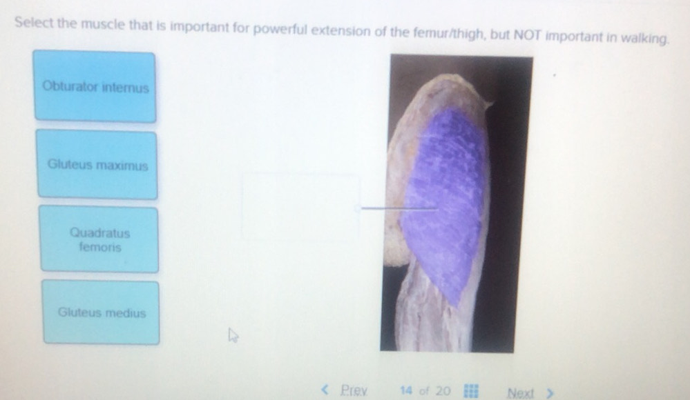 Solved: Select the muscle that is important for powerful extension of ...
