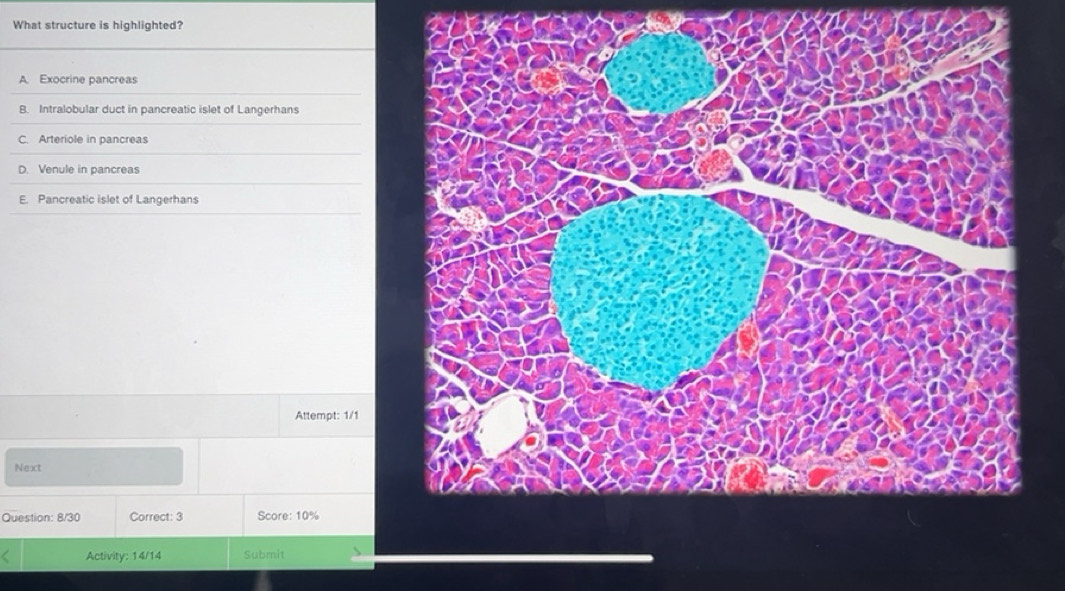 Solved: What structure is highlighted? A. Exocrine pancreas B ...