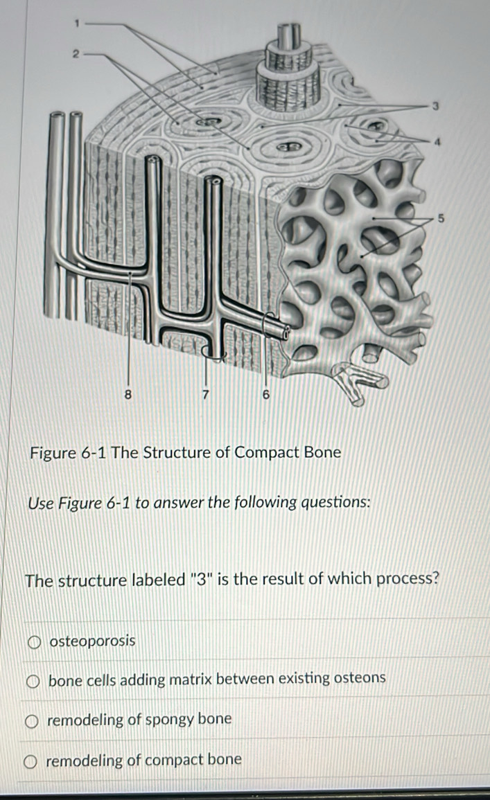 Solved: Figure 6-1 The Structure of Compact Bone Use Figure 6-1 to answer the following ...