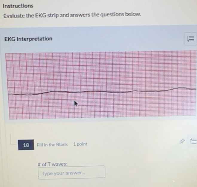 Solved: Instructions Evaluate the EKG strip and answers the questions ...