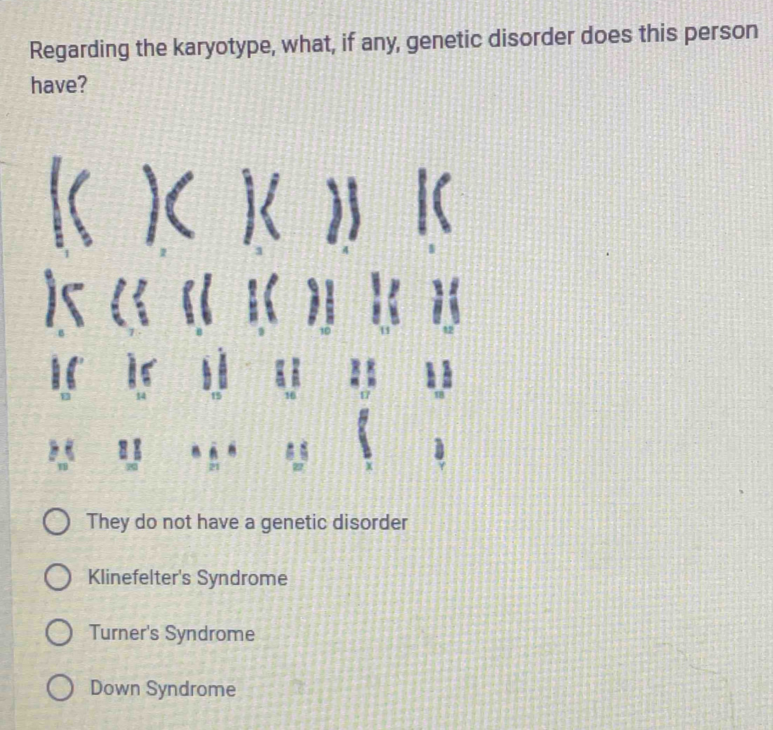 Solved: Regarding the karyotype, what, if any, genetic disorder does ...