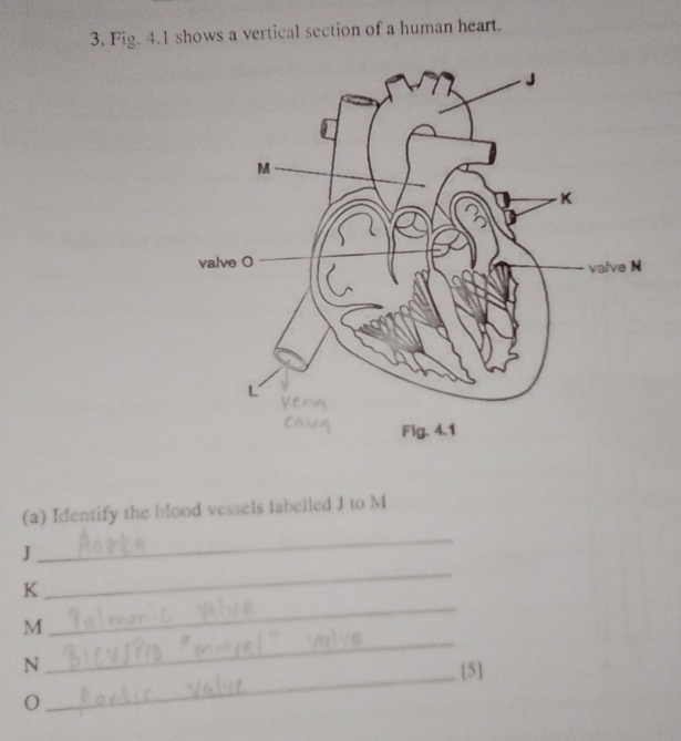 Solved: Fig. 4.1 shows a vertical section of a human heart. (a ...