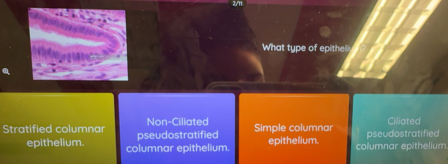 Solved: 2/11 What type of epitheli Non-Ciliated Ciliated Stratified ...