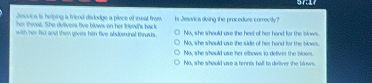 Solved: 57:17 Jessica is helping a friend dislodge a piece of meat from ...