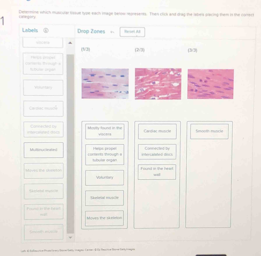 Solved: Determine which muscular tissue type each image below ...