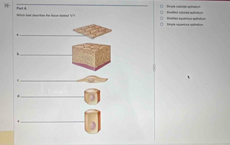 Solved: Simple cuboidal epithslium Stratified cuboidal epithstium Which ...