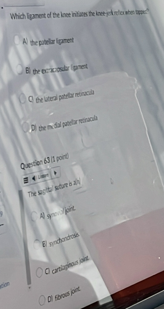 Solved: Which ligament of the knee initiates the knee-jerk reflex when ...