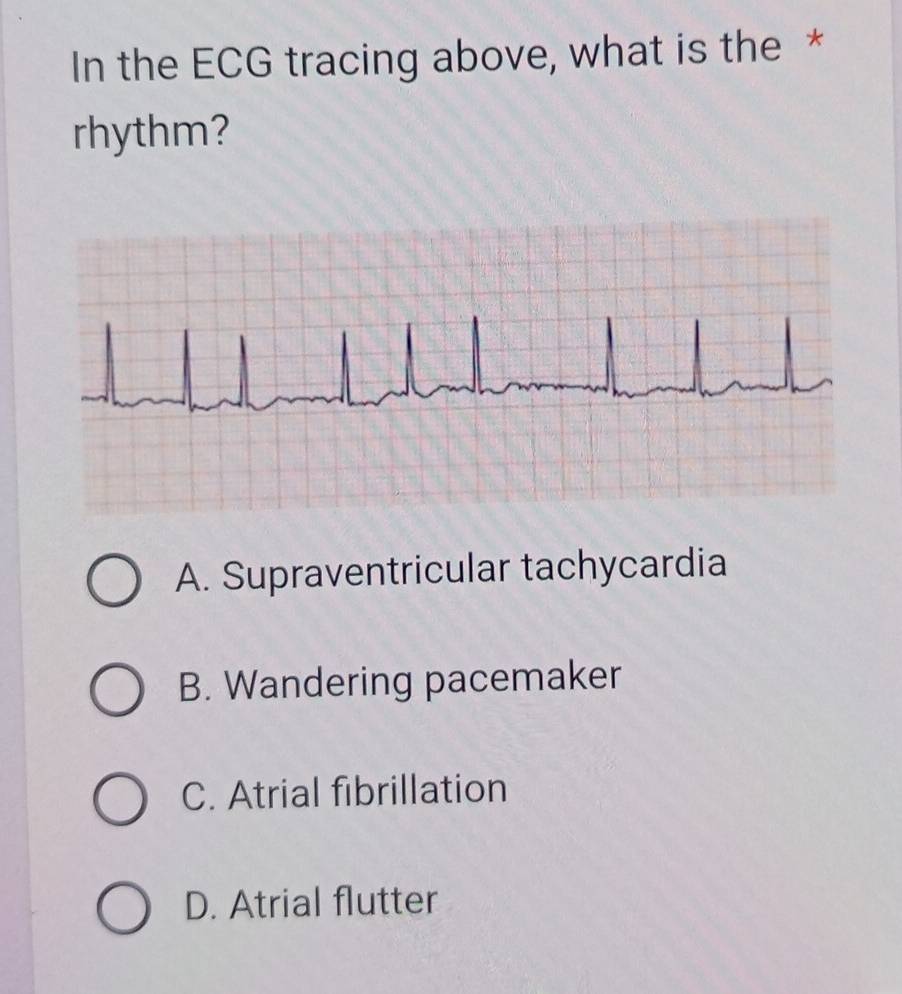 Solved: In the ECG tracing above, what is the * rhythm? A ...