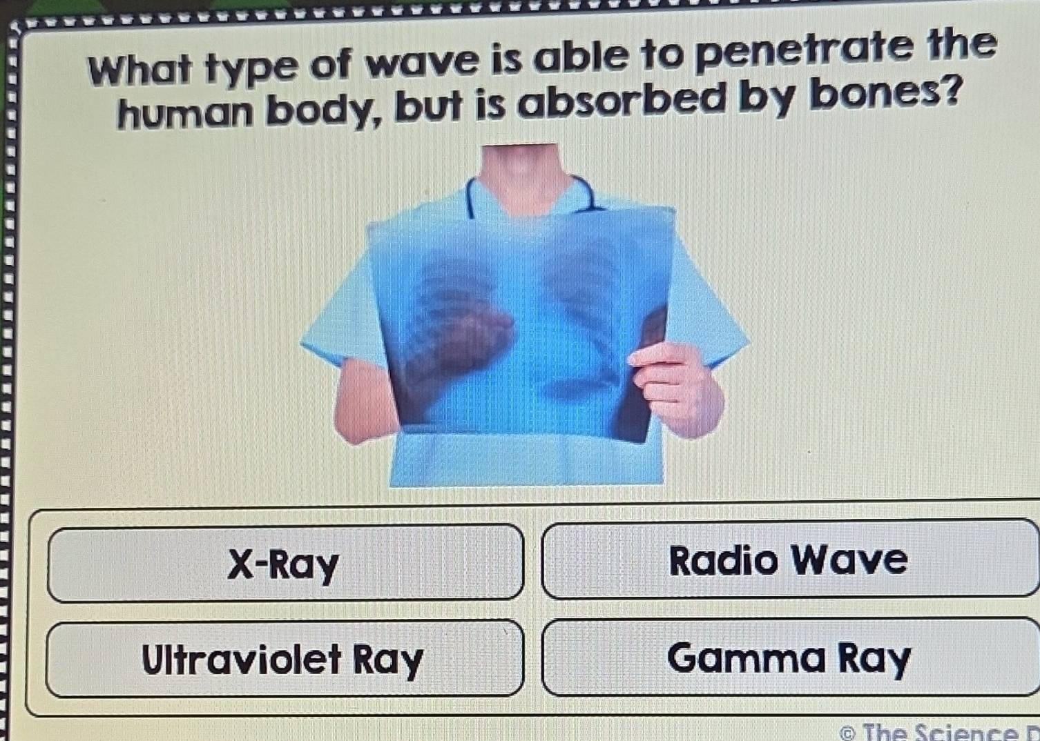 Solved: What type of wave is able to penetrate the human body, but is ...
