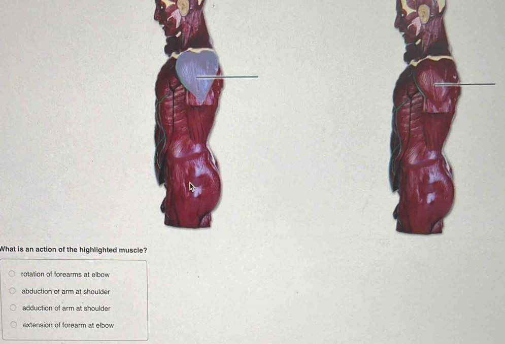 Solved: What is an action of the highlighted muscle? rotation of ...