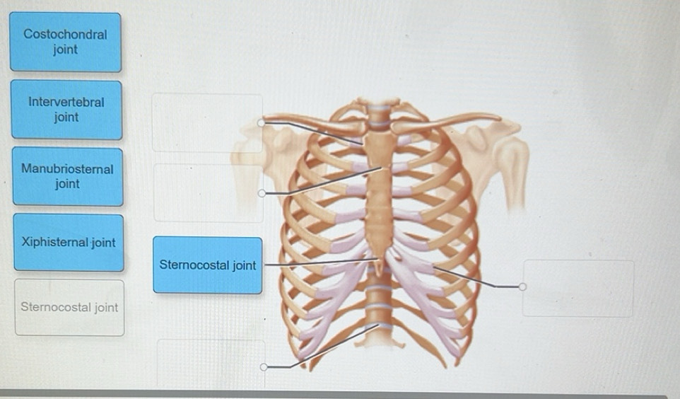 Solved: Costochondral joint Intervertebral joint Manubriosternal joint ...