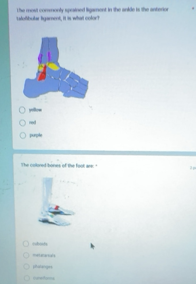 Solved: The most commonly sprained ligament in the ankle is the ...