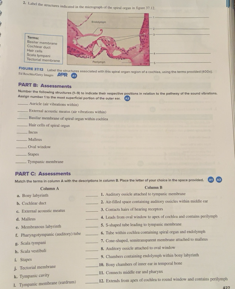 Solved: Label the structures indicated in the micrograph of the spiral ...