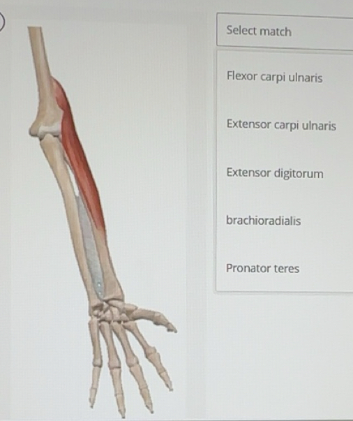 Solved: Select match Flexor carpi ulnaris Extensor carpi ulnaris ...
