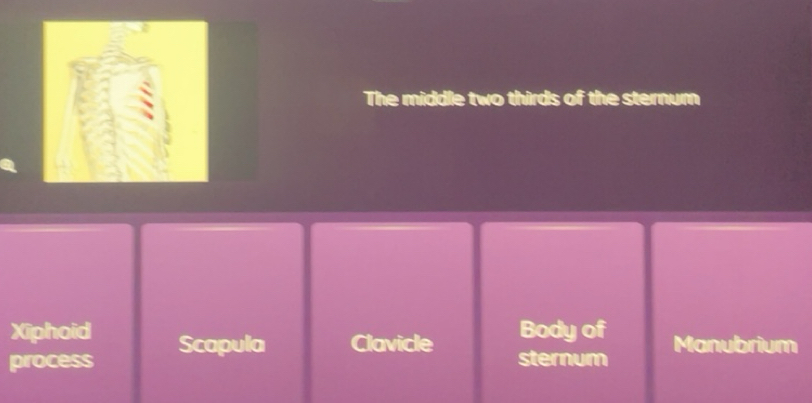 Solved: The middle two thirds of the sternum Xiphoid Body of process ...