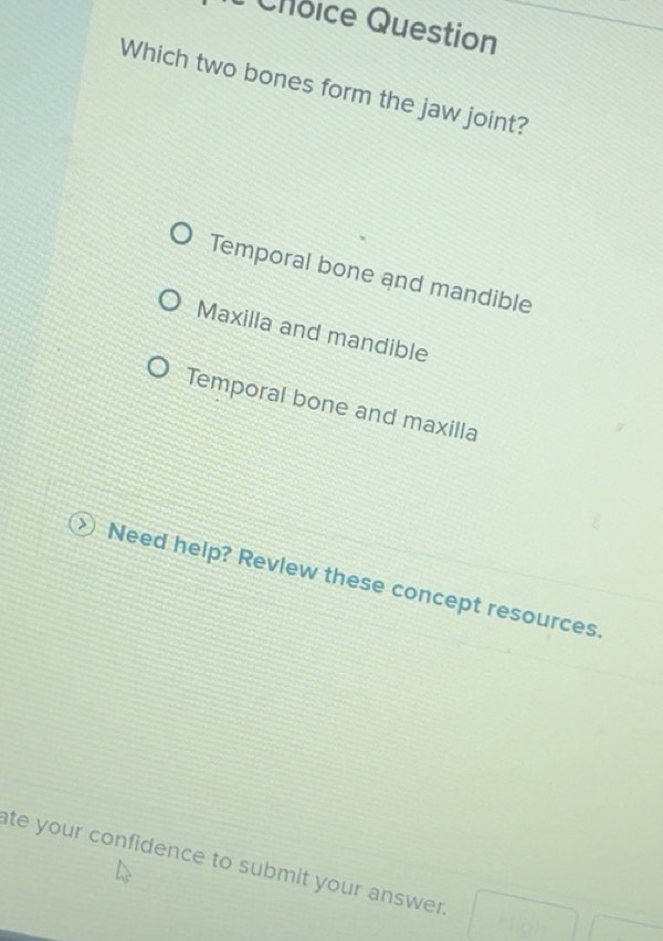 Solved: Choice Question Which two bones form the jaw joint? Temporal bone and mandible Maxilla ...