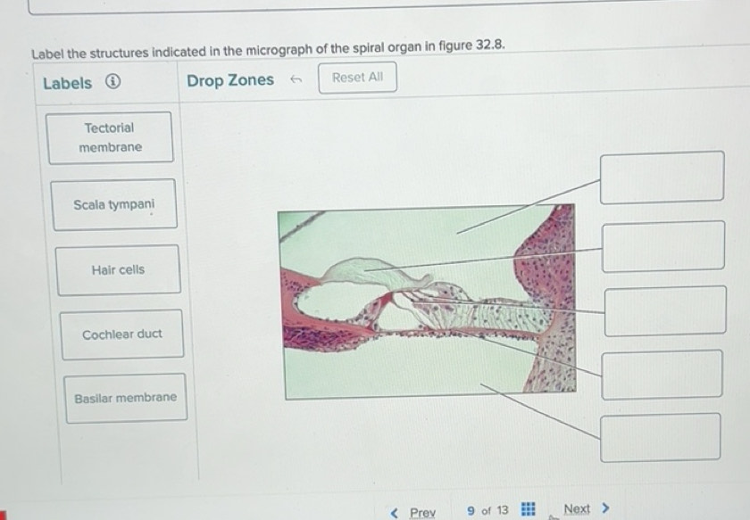 Solved: Label the structures indicated in the micrograph of the spiral ...