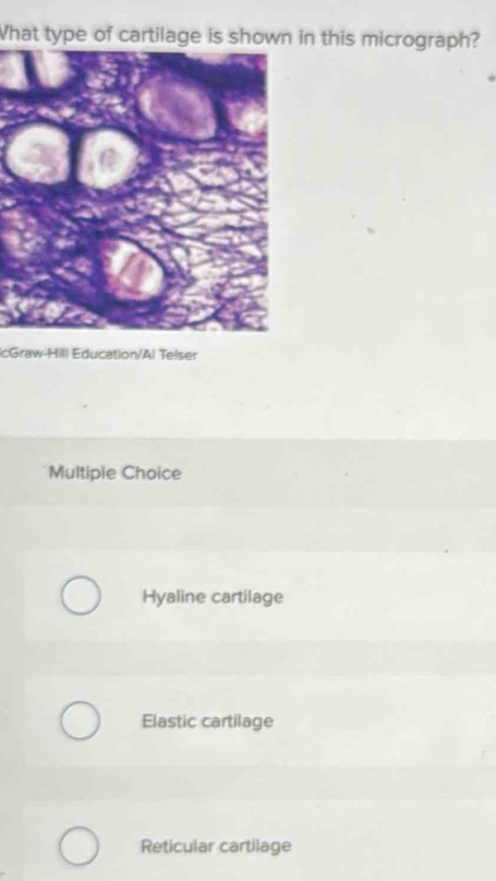 Solved: What type of cartilage is shown in this micrograph? cGraw-Hill ...