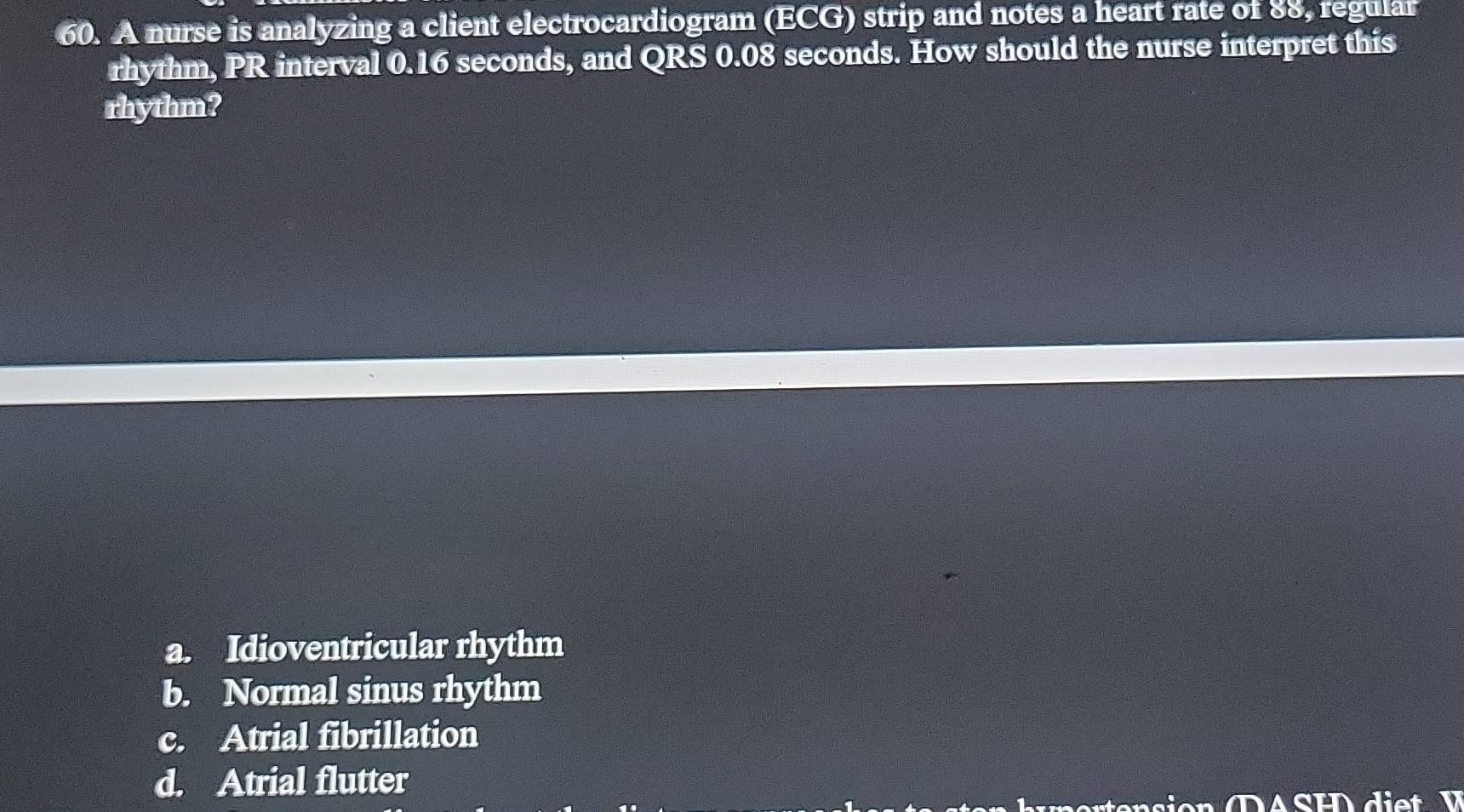 Solved: A nurse is analyzing a client electrocardiogram (ECG) strip and ...