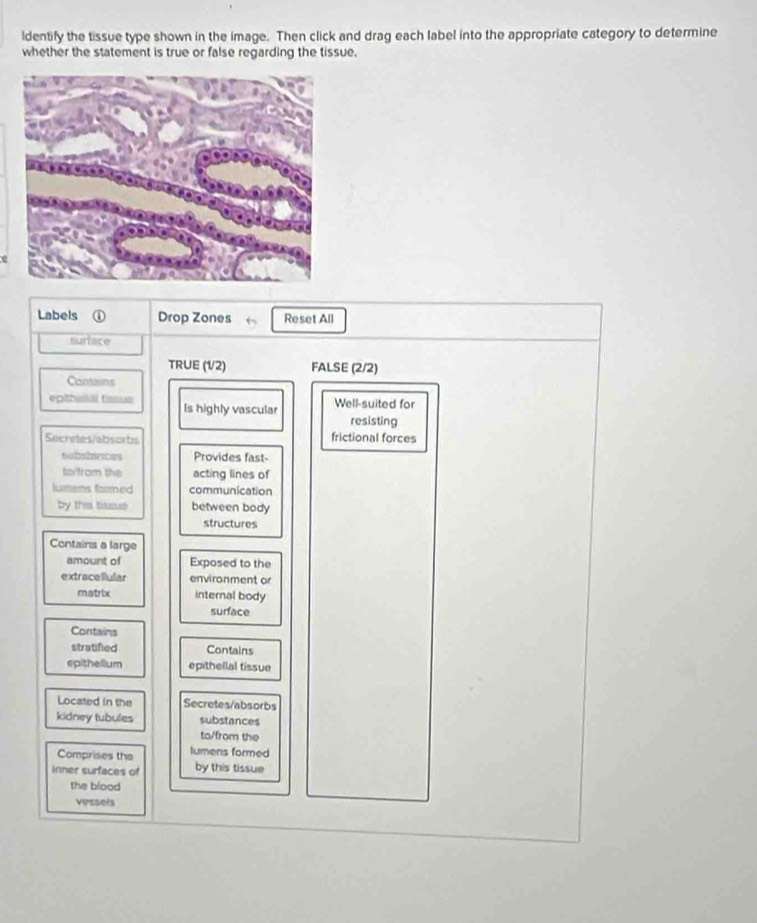 Solved: ldentify the tissue type shown in the image. Then click and drag each label into the ...