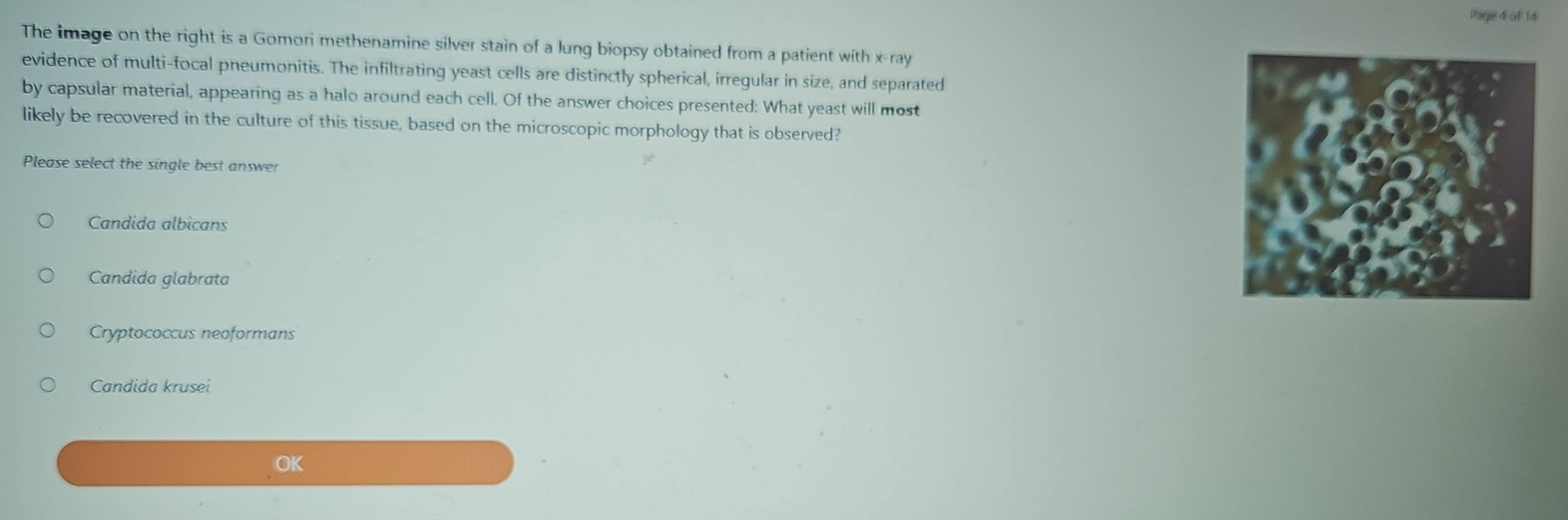 Solved: Page 4 of 14 The image on the right is a Gomori methenamine ...