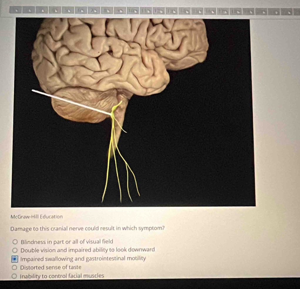 Solved: 126 1 . McGraw-Hill Education Damage to this cranial nerve ...