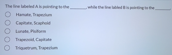 Solved: The line labeled A is pointing to the _, while the line labled ...